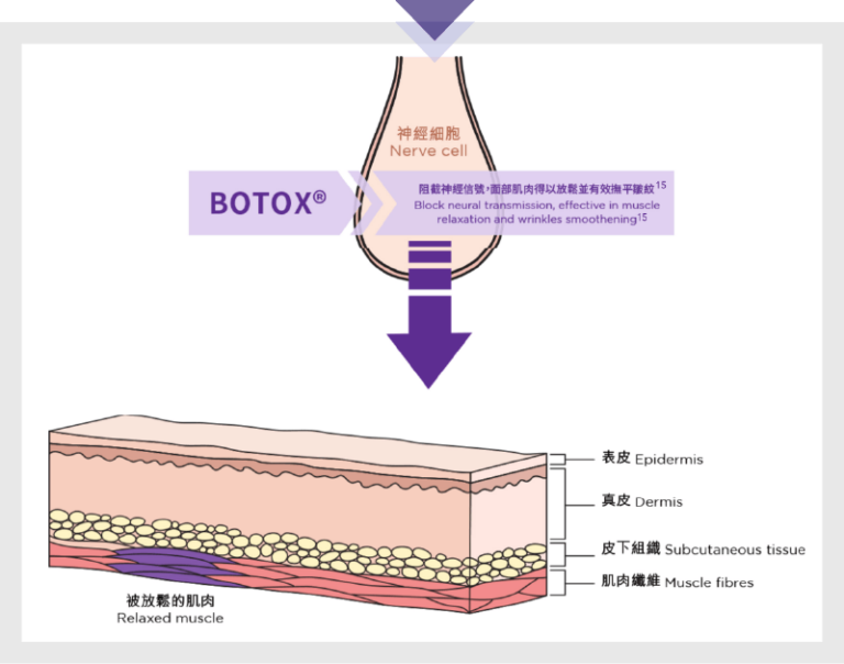 BOTOX V面塑形療程 | DR REBORN 香港最大醫療美容集團, 醫學美容中心客戶留存率為97%